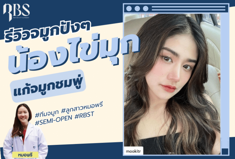 RBS clinic ครบเครื่องเรื่องความงามไม่ต้องบินไกลถึงเกาหลี