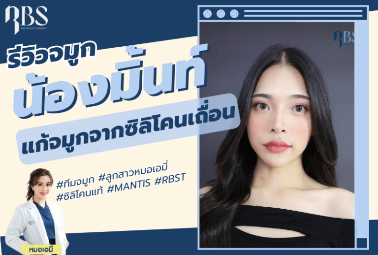 RBS clinic ครบเครื่องเรื่องความงามไม่ต้องบินไกลถึงเกาหลี